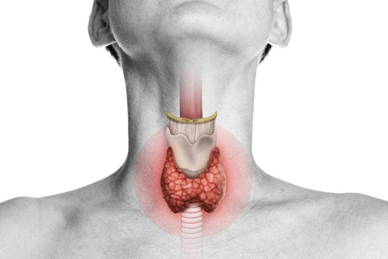 Thyroid Nodule Diagnosis And Treatment By Endocrinologist Dr Zaidi